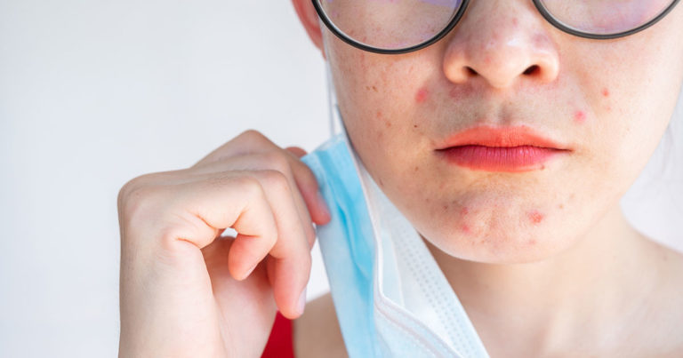 What Can Stress Do to My Skin? | Does Anxiety Affect Your Skin?